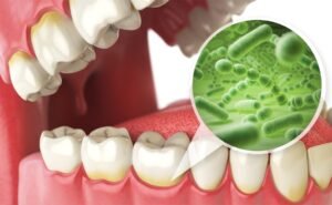 I Tried DentaSmile Pro – Here’s My Honest Review - PeekViews