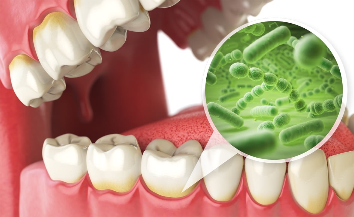 I Tried DentaSmile Pro – Here’s My Honest Review - PeekViews